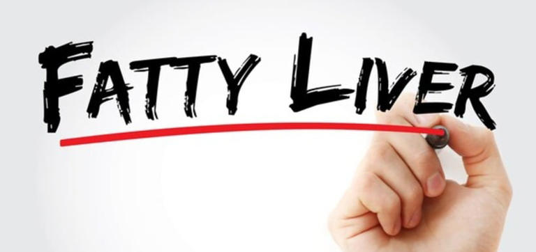 Fatty Liver: Types, Symptoms, Diagnosis and Treatments