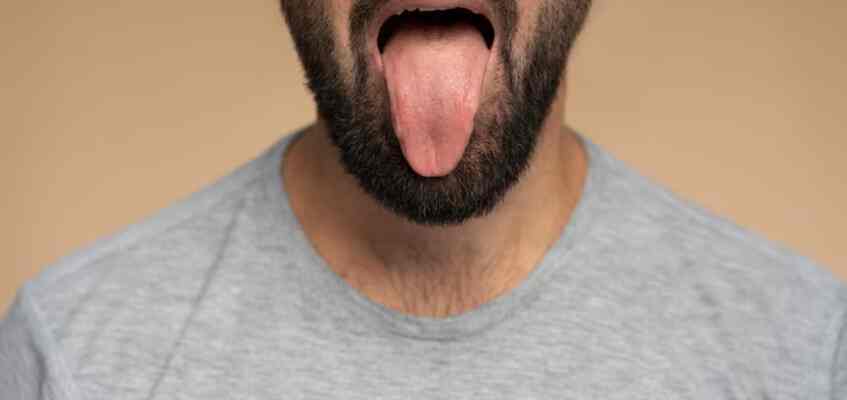 Tongue Cancer: Symptoms, Causes, Diagnosis, Treatment and Prevention
