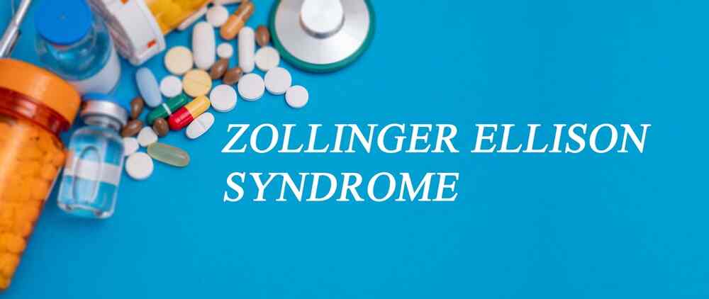Zollinger Ellison Syndrome: Complications, Symptoms, Diagnosis and ...