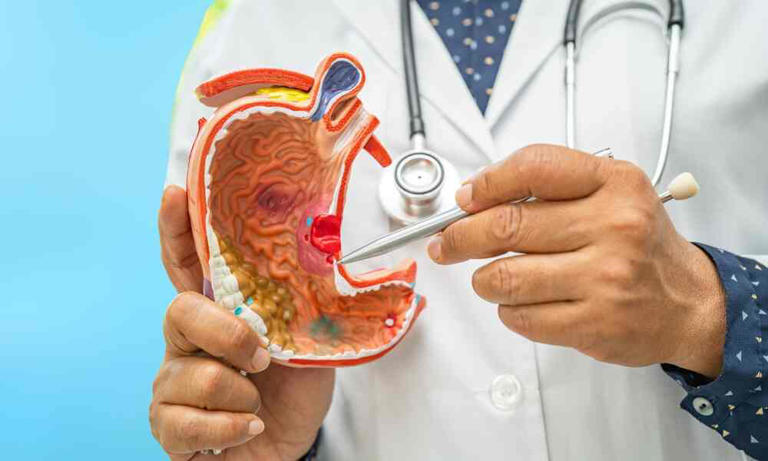 Gastritis: Types, Causes, Symptoms, Treatments and Prevention