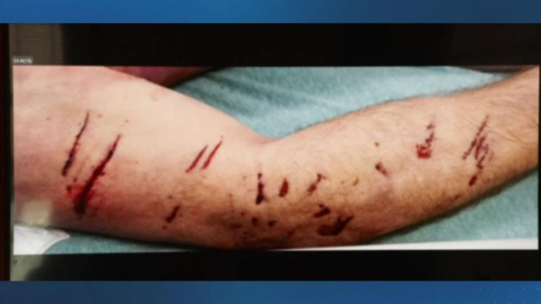 Live video, updates: Dog bite expert testifying in Karen Read’s retrial