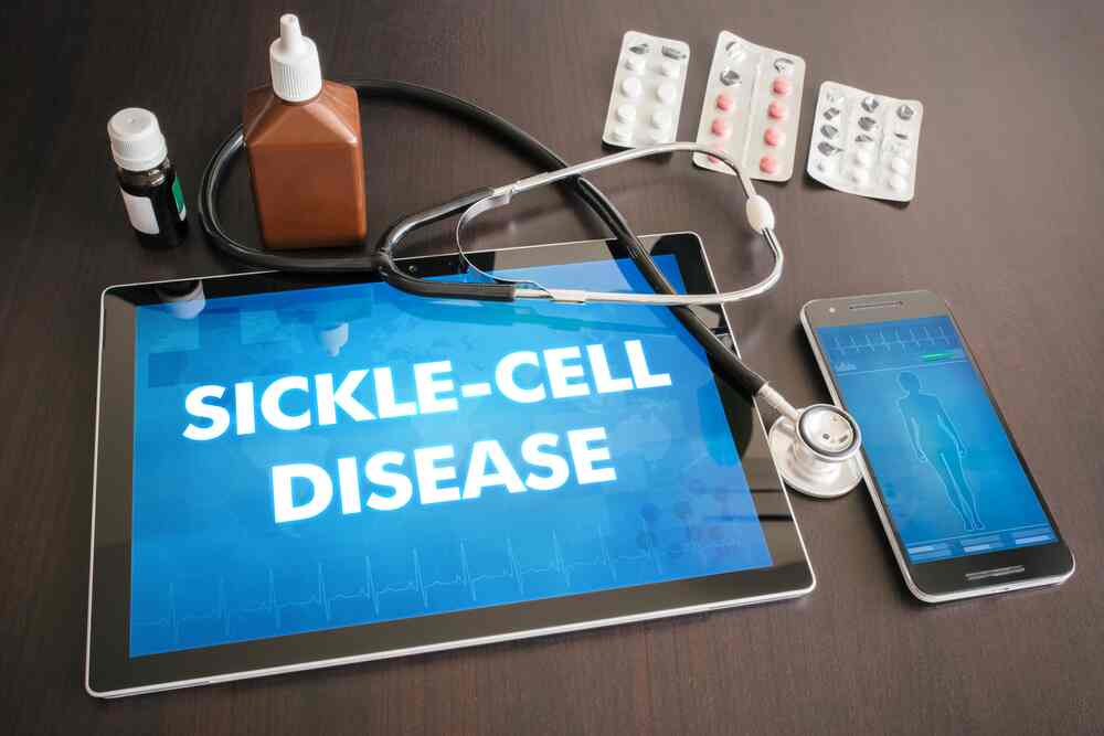 Breaking Down Sickle Disease: Key Facts on Symptoms, Diagnosis, and ...