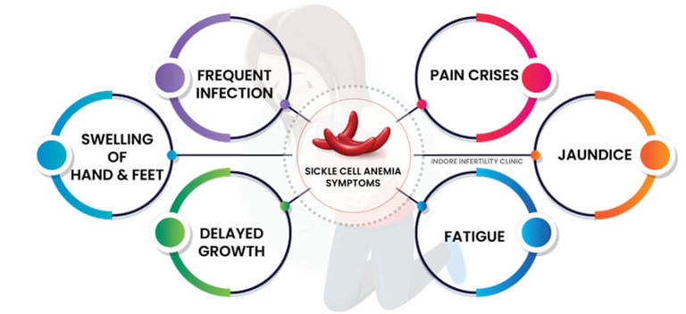 Breaking Down Sickle Disease: Key Facts on Symptoms, Diagnosis, and ...