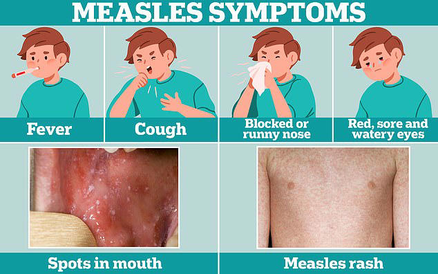 Urgent health warning as most contagious disease on Earth is detected ...