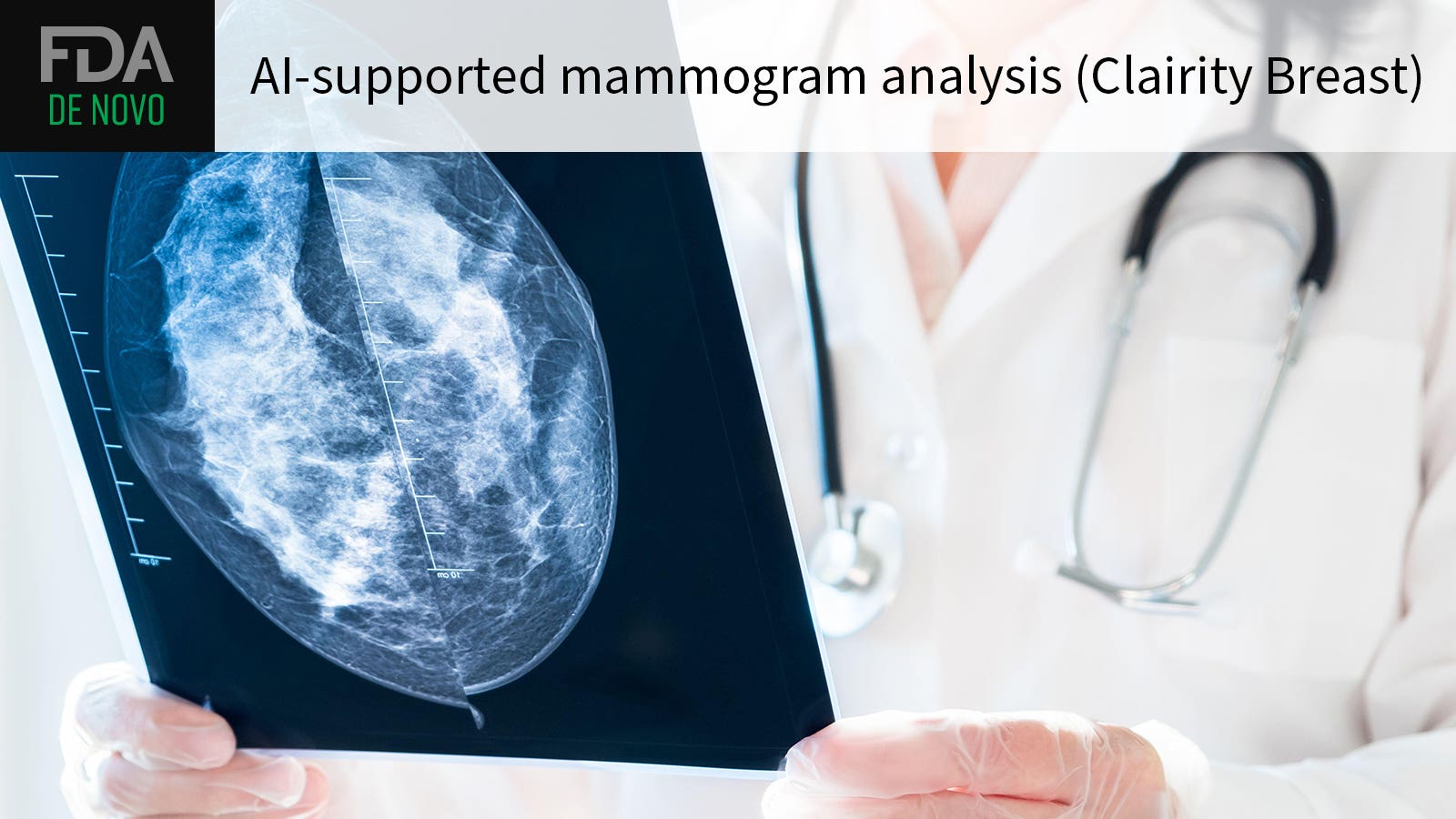 FDA Authorizes AI Platform for Breast Cancer Risk Prediction