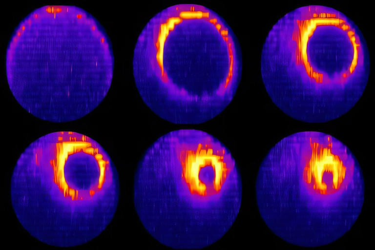 Working model reveals how protein anillin controls asymmetry during ...