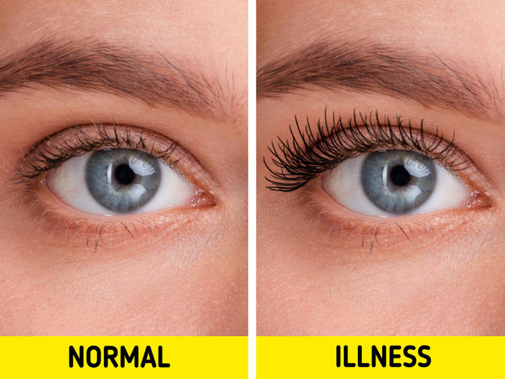 5 Subtle Clues That Could Reveal Hidden Health Problems