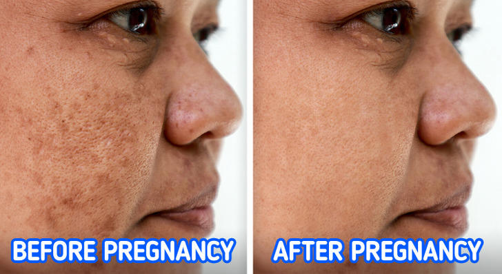 5 Subtle Clues That Could Reveal Hidden Health Problems