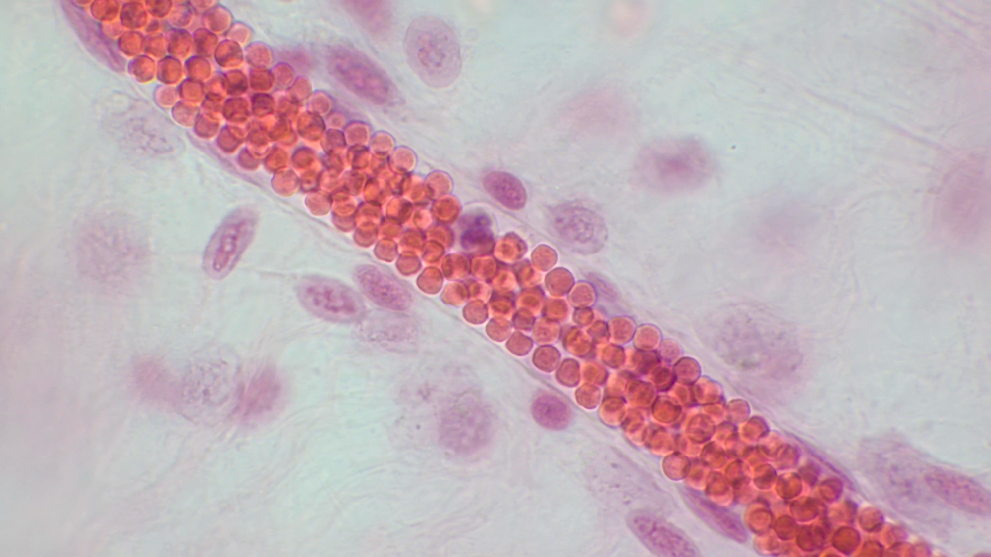 Study shows MMA sparring hits blood health harder than boxing