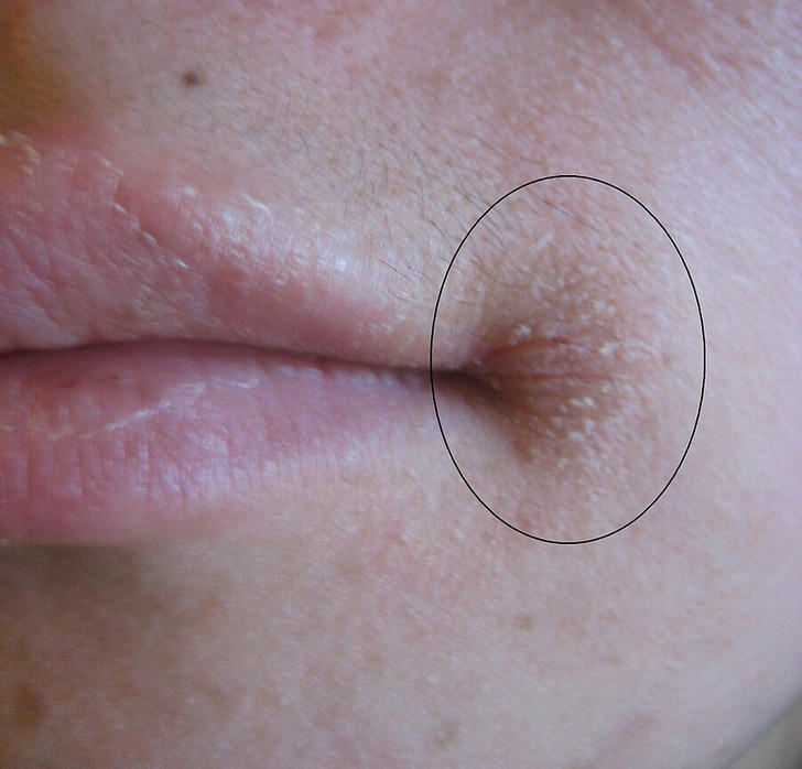 5 Subtle Clues That Could Reveal Hidden Health Problems