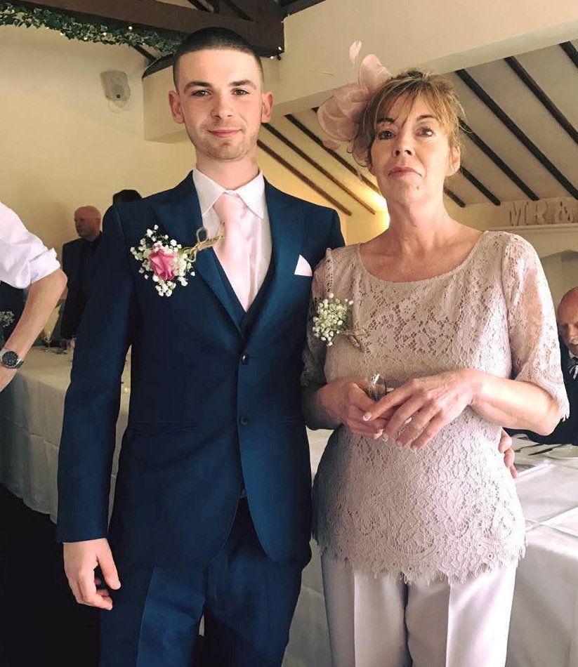 Man’s blackouts mid-conversation turned out to be brain tumour