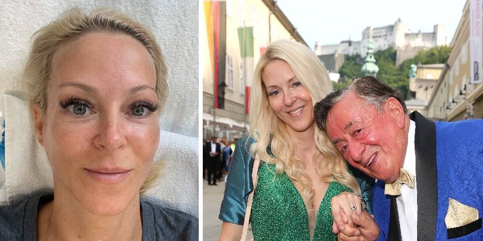 Simone Lugner: Beauty-Eingriff nach Dancing Stars