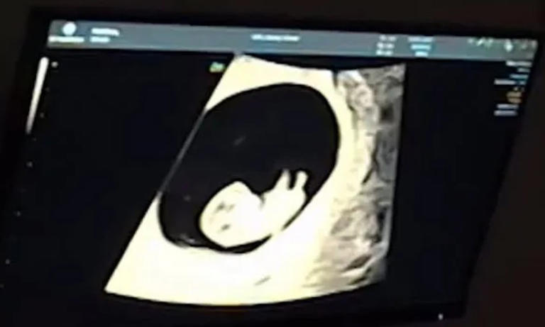 Sophie Habboo debuts baby bump after revealing she’s expecting first ...