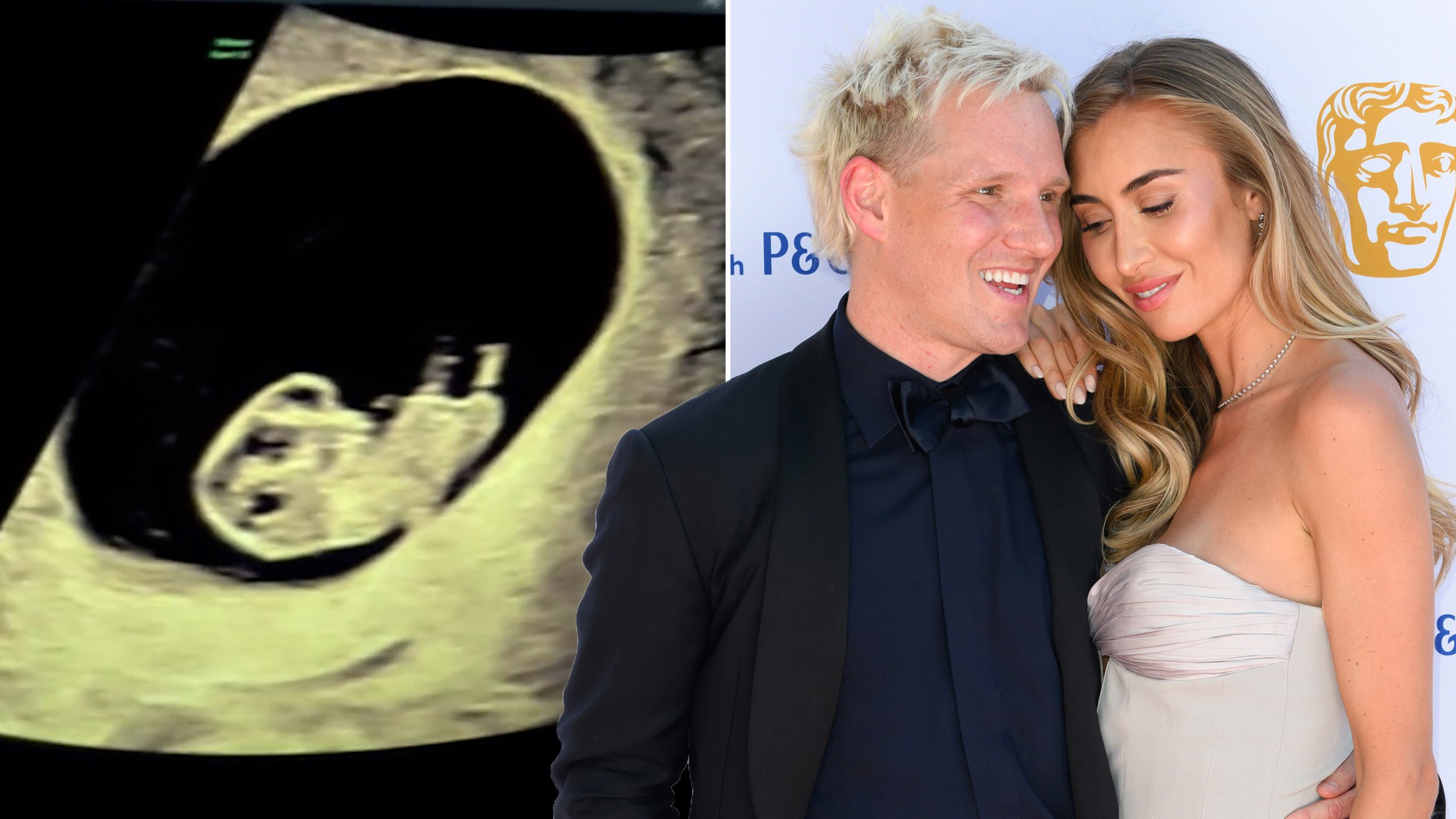 Jamie Laing and Sophie Habboo announce they’re expecting first baby ...