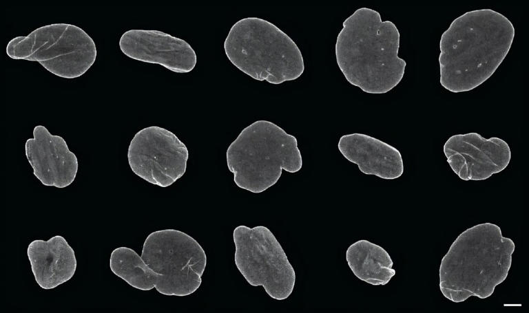 ExIGS bridges microscopy and sequencing to track nuclear abnormalities