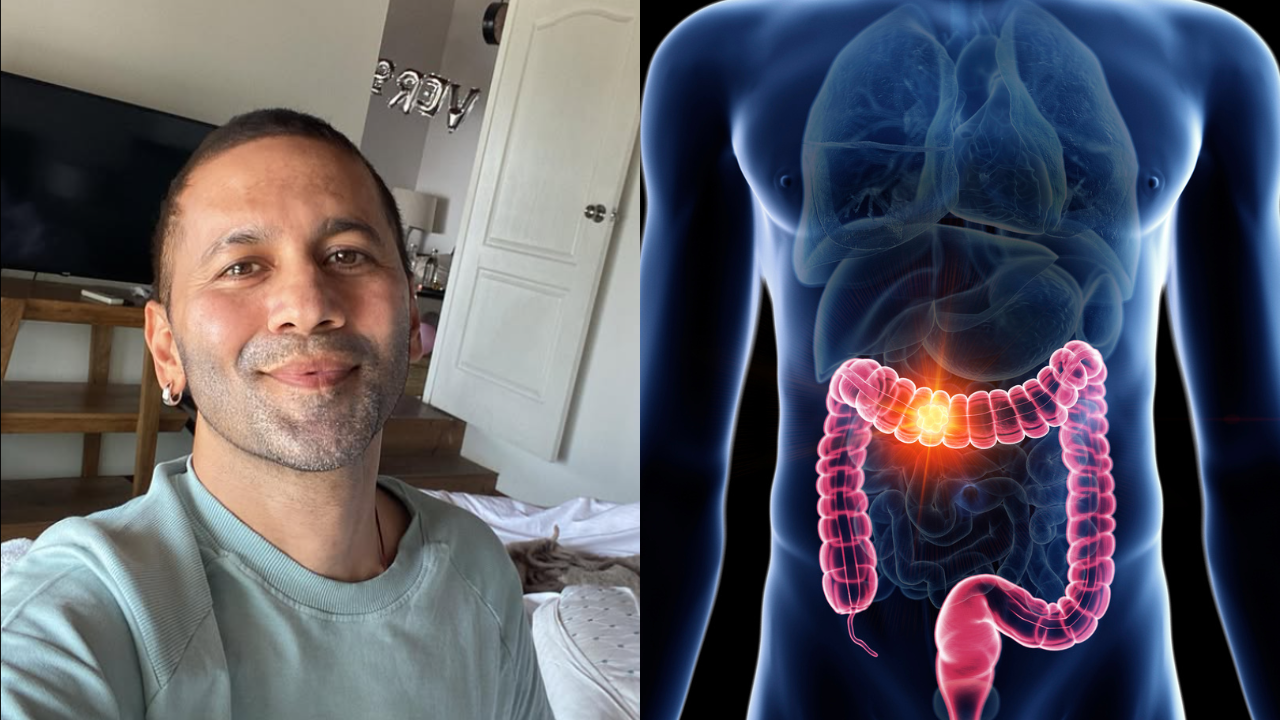 Vibhu Raghave’s Demise from Stage 4 Colon Cancer Is a Wake-Up Call on ...