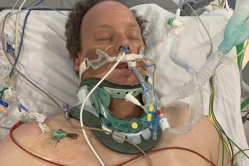 Man decapitated in car crash recovers with help of one exercise