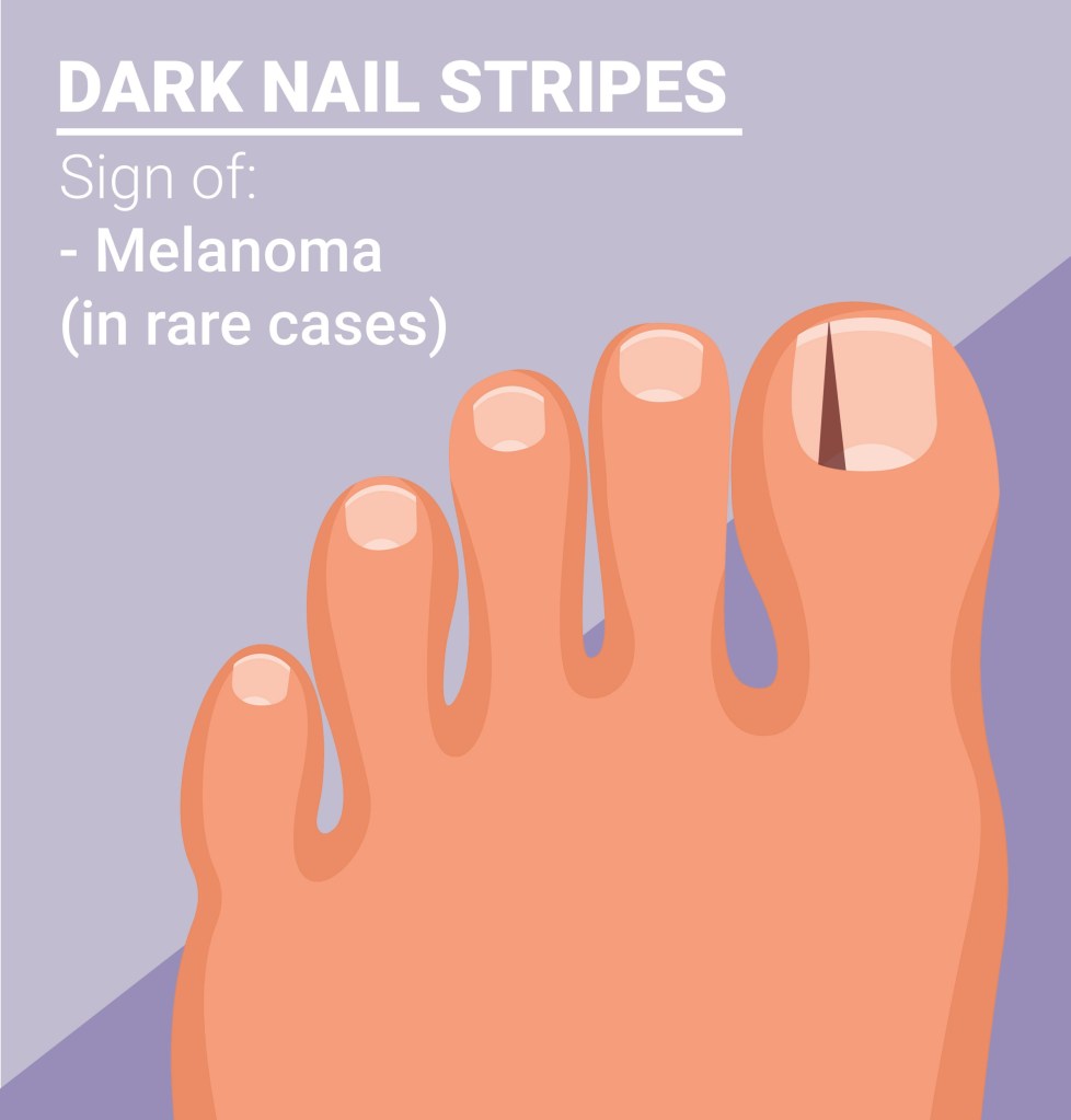 What your toes say about your health — 8 warning signs to look out for
