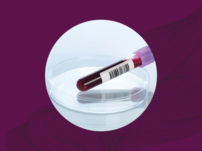 UPDATE: A Groundbreaking Alzheimer's Blood Test Is Now FDA-Approved