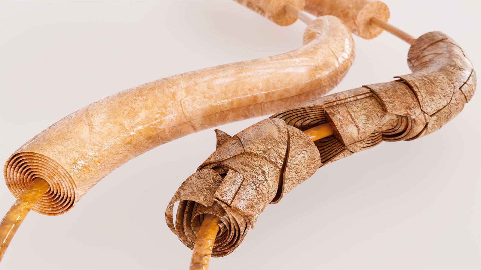 MS Disability Progression May Vary by Race, Ethnicity