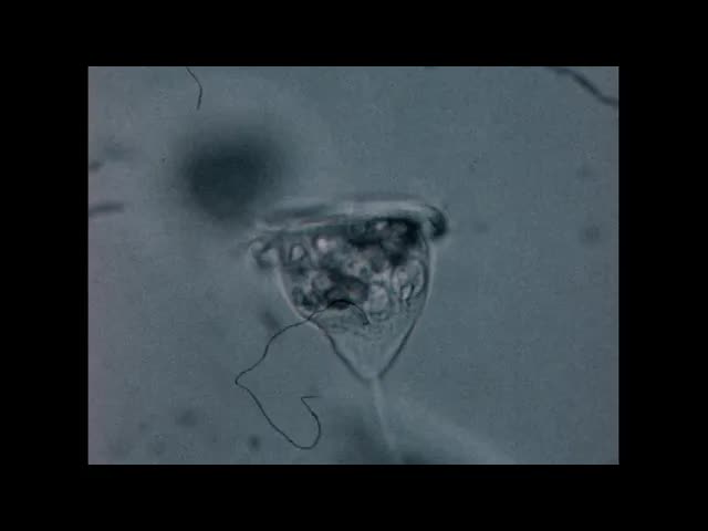 Microscopic Wonders: Amoeba, Desmids & Diatoms