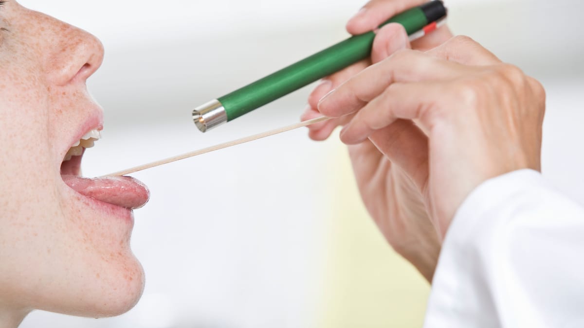 Mandelsteine oder Eiter durch Mandelentzündung: Unterschiede erkennen