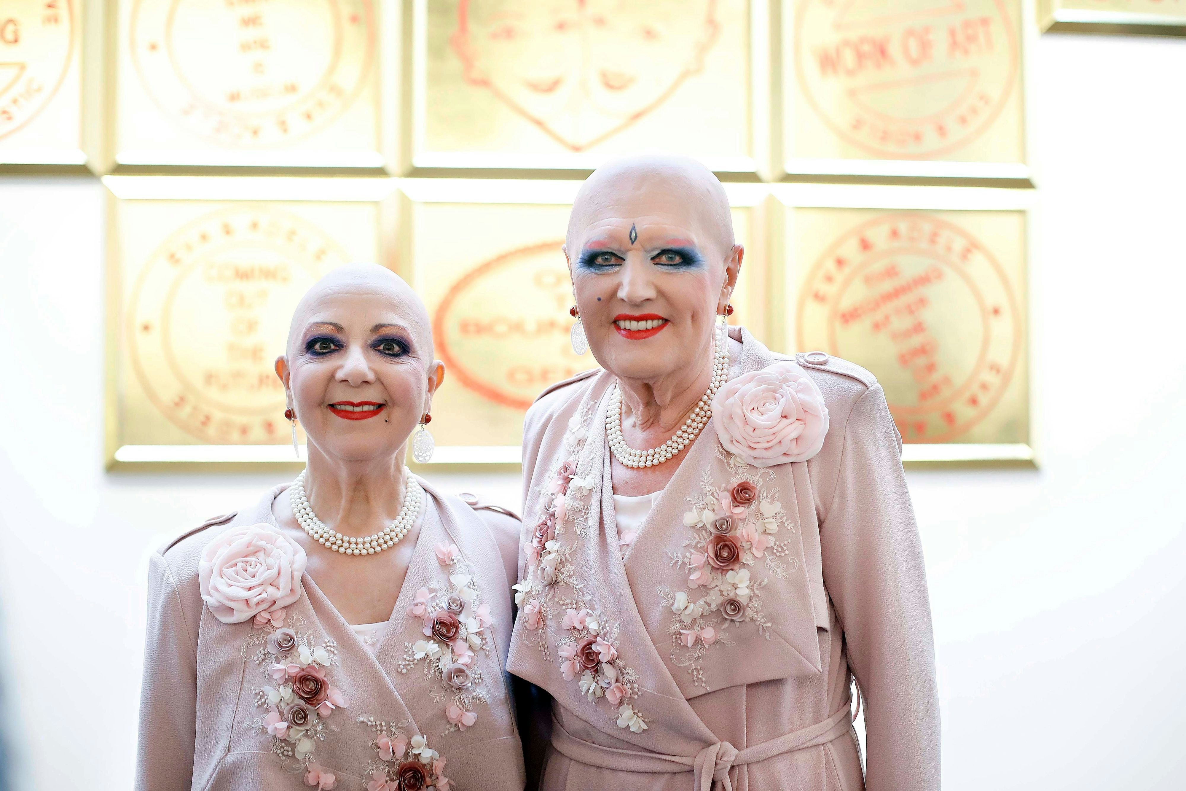 Lebendes Kunstwerk verliert eine Hälfte: Eva von Eva & Adele ist tot