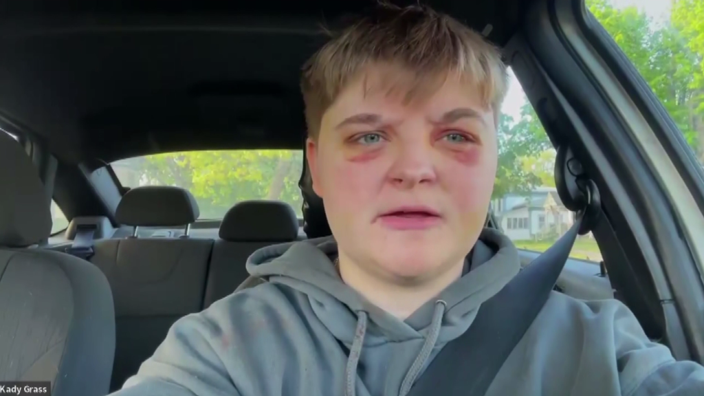 Illinois prosecutors weigh hate crime charges after lesbian attacked at ...