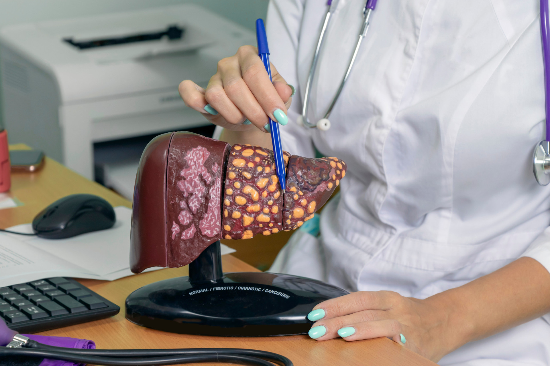 What do the different stages of cancer mean?