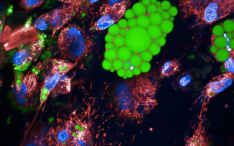 Twin study sheds light on how mitochondria influence the gene ...