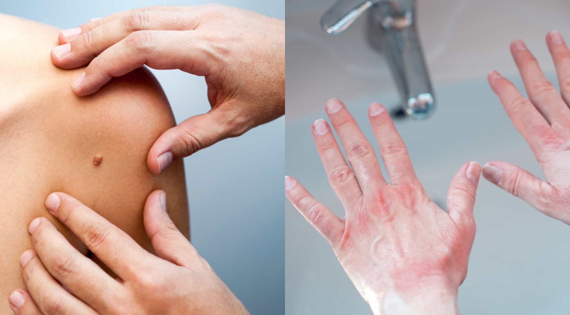 The most common skin conditions, and their cures