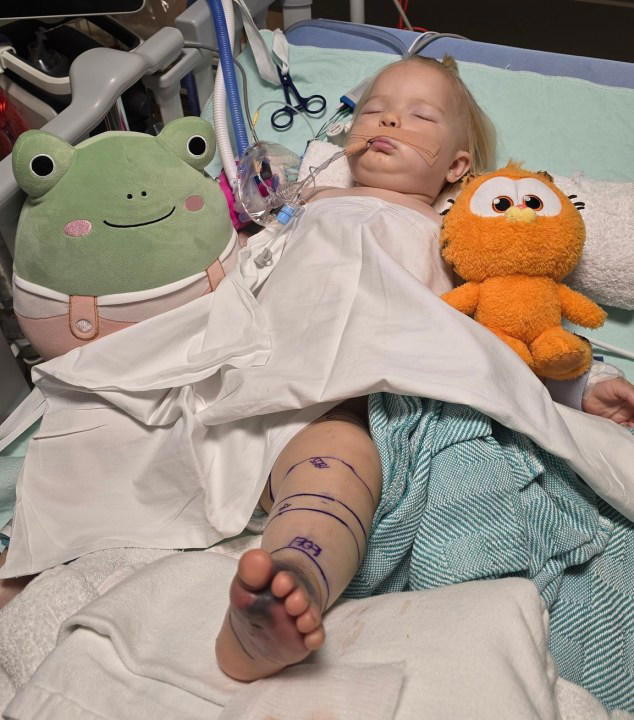 ‘She’s a miracle’: Toddler bitten twice by rattlesnake, receives over ...