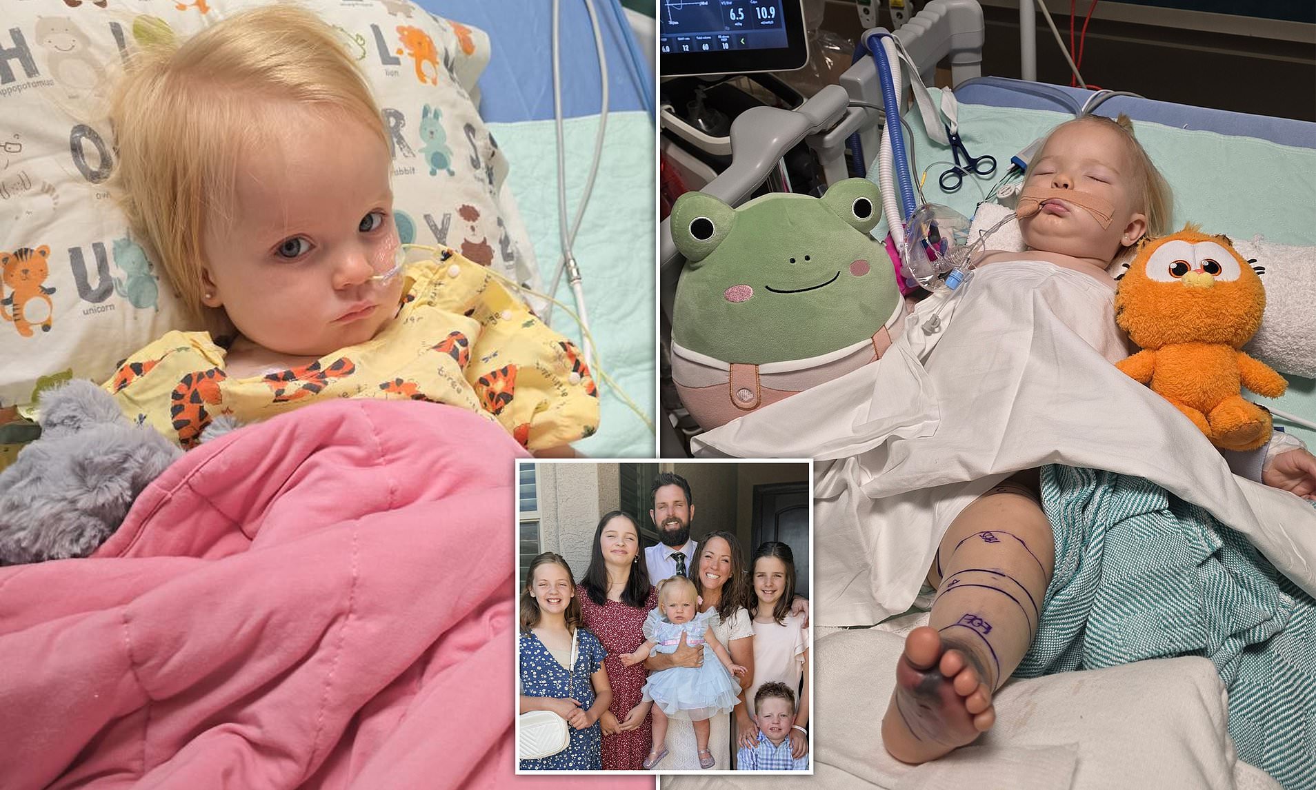 Little girl 'no longer smiles' after receiving 30 vials of antivenom