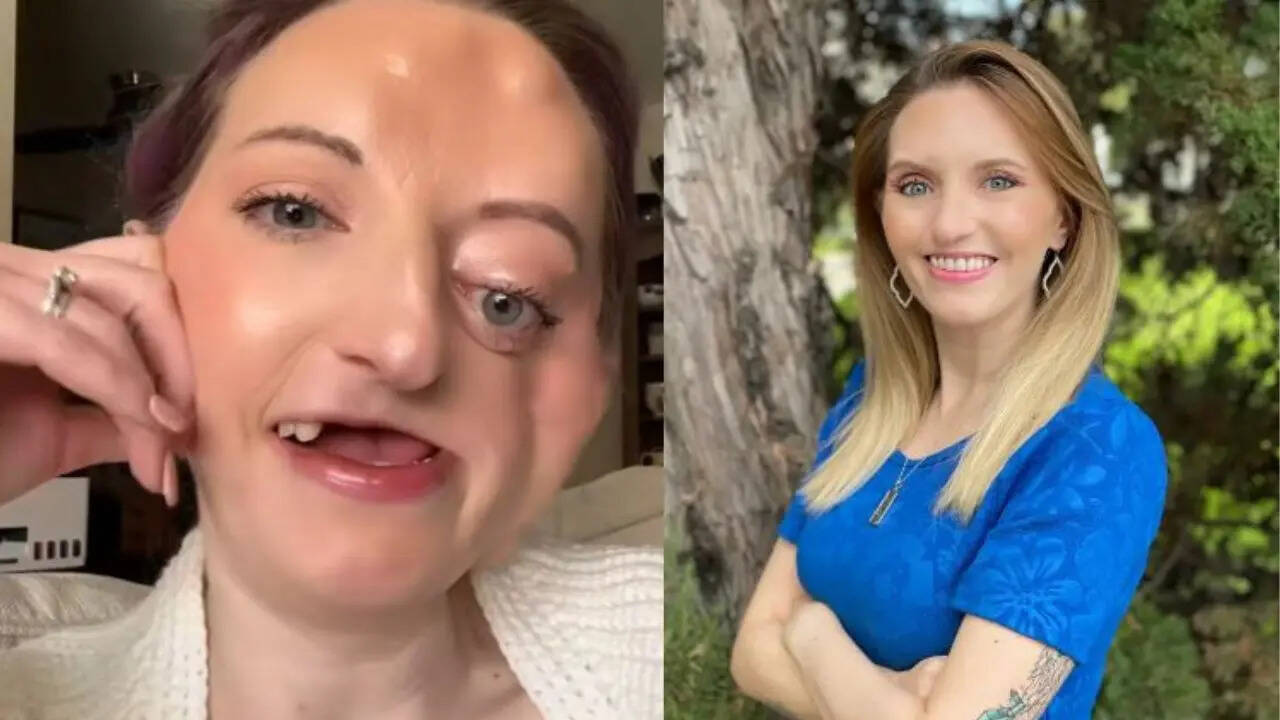 Influencer Says Boyfriend's Fart on Face Gave Her a Deadly E. Coli ...