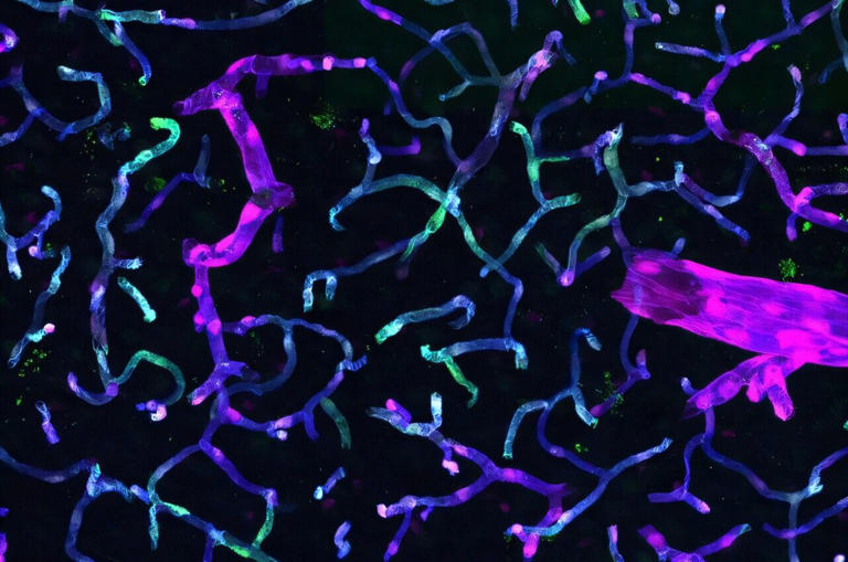 Researchers contribute to new toolkit for battling brain disorders