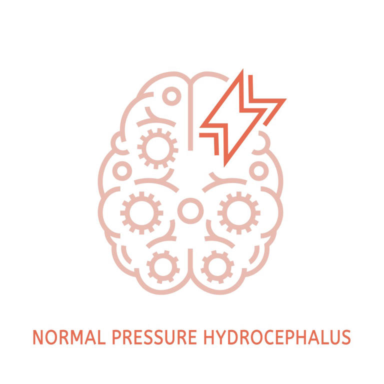 What is normal pressure hydrocephalus (NPH)? All about the brain condition affecting Billy Joel