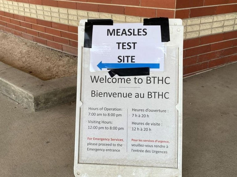 Measles exposure alert issued for two Manitoba schools