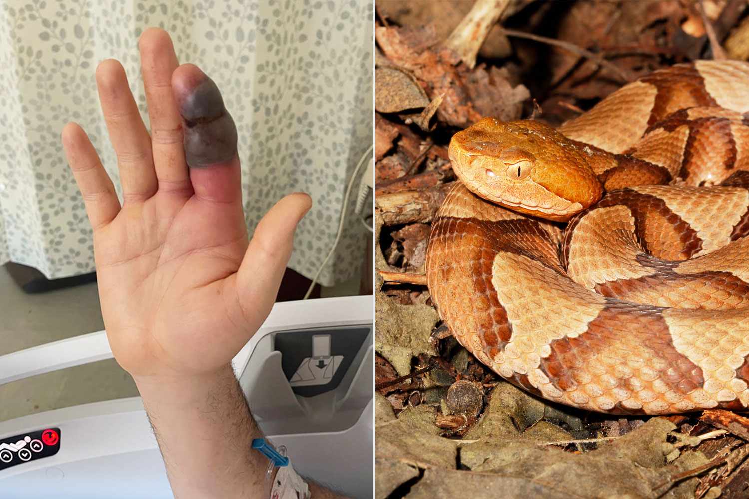Man Tries to Save Snake Not Knowing It Was Venomous. He Spent 2 Nights ...