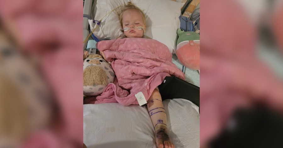 ‘She’s a miracle’: Toddler bitten twice by rattlesnake, receives over ...