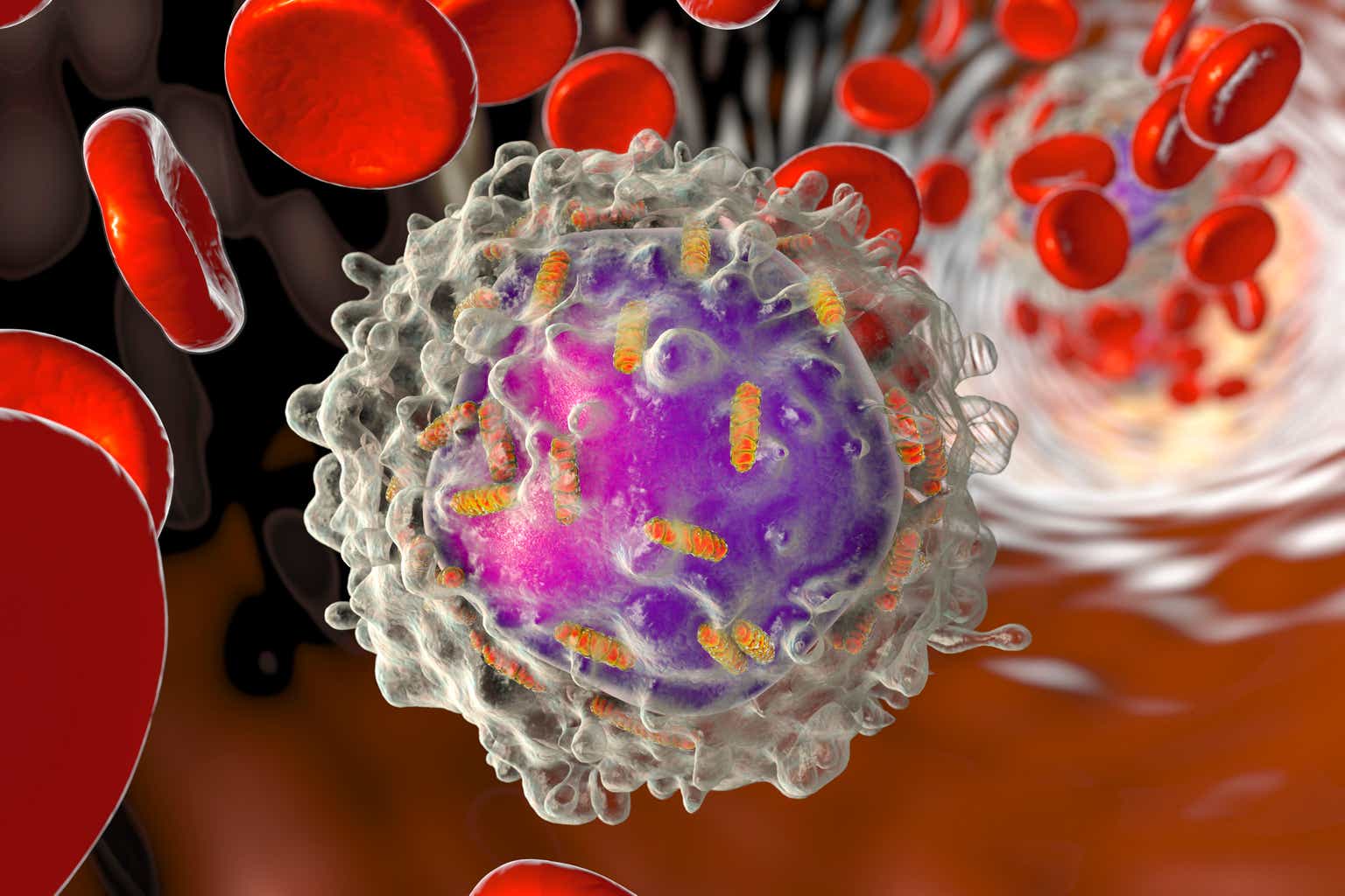 Autolus Therapeutics gets EU endorsement for leukemia treatment