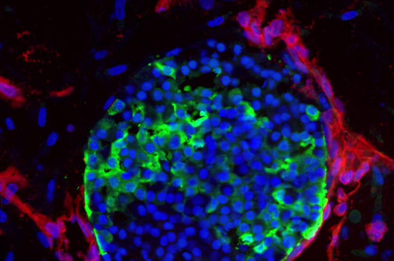 Vascularized stem cell islet organoids offer improved model for ...
