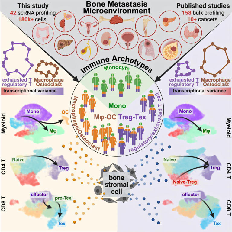 Single Cell Rna Sequencing Of Bone Metastases From Multiple Cancer