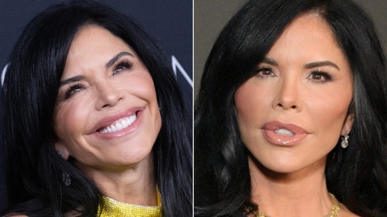 Unfiltered Pics Of Lauren Sanchez Don't Do Her Face Work Any Favors