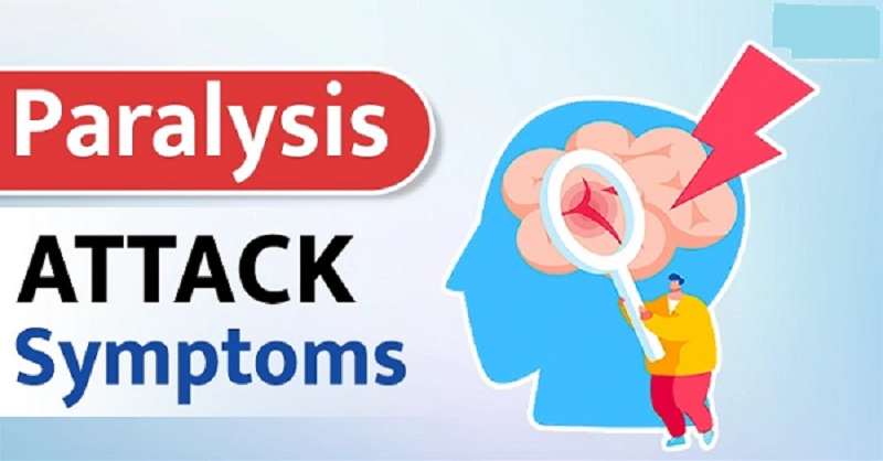 As soon as you get a paralysis attack, if you do just this one remedy ...