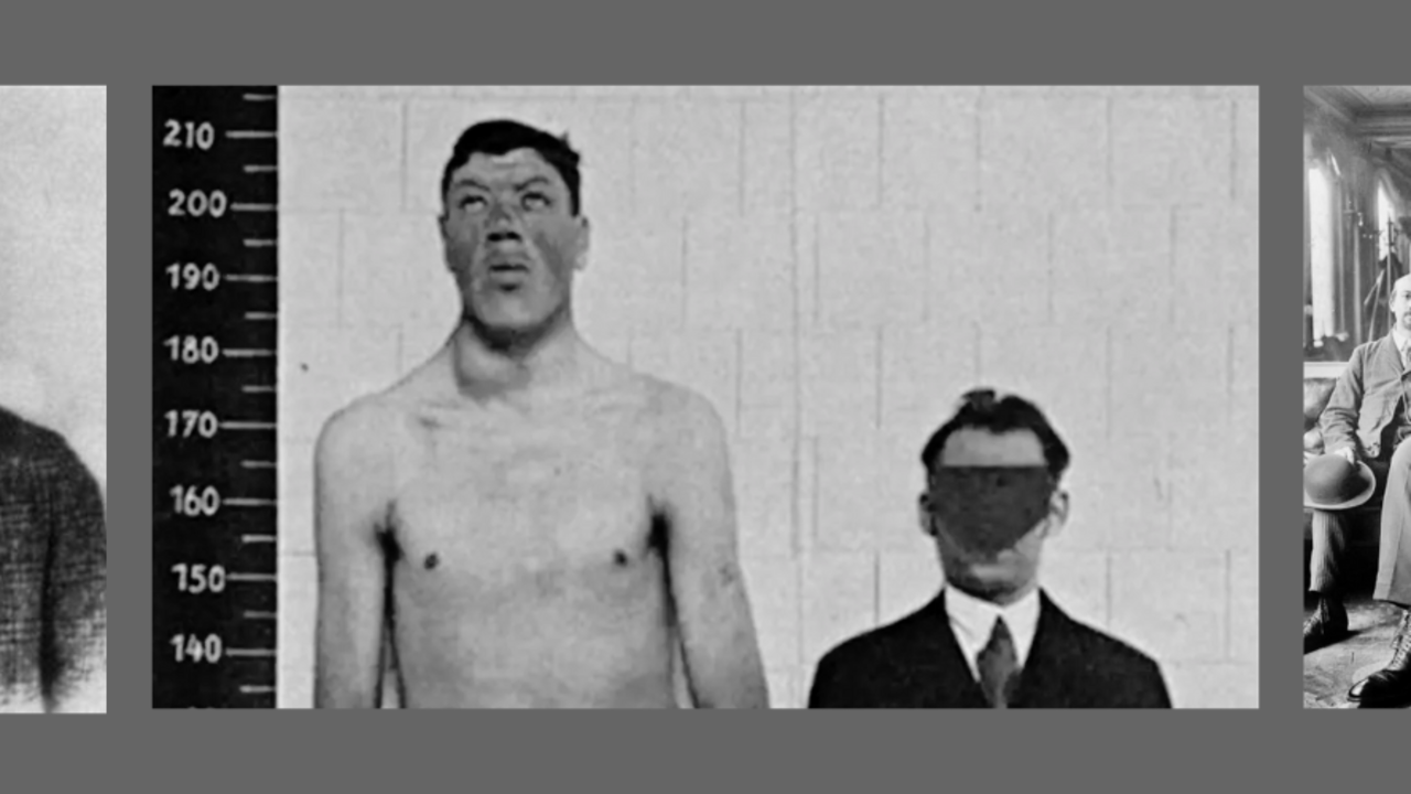Meet Adam Rainer, The Man Who Was Born A Dwarf, But Grew Into A Giant ...