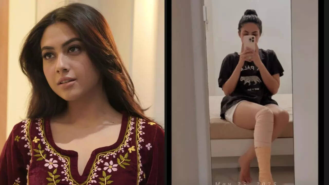 Reem Shaikh injures herself on the sets of Laughter Chefs 2; shares a ...