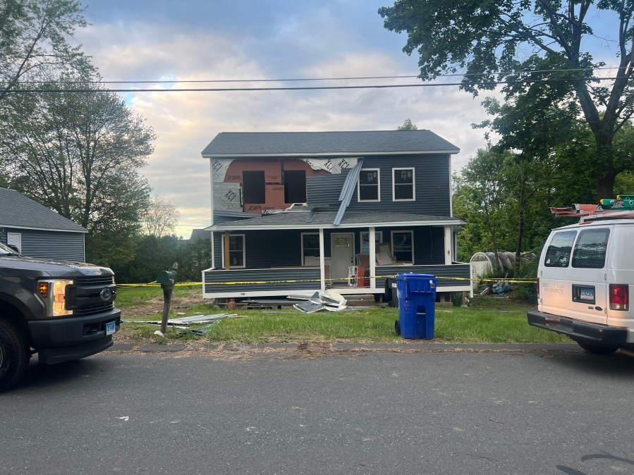 One person seriously burned from explosion in Suffield