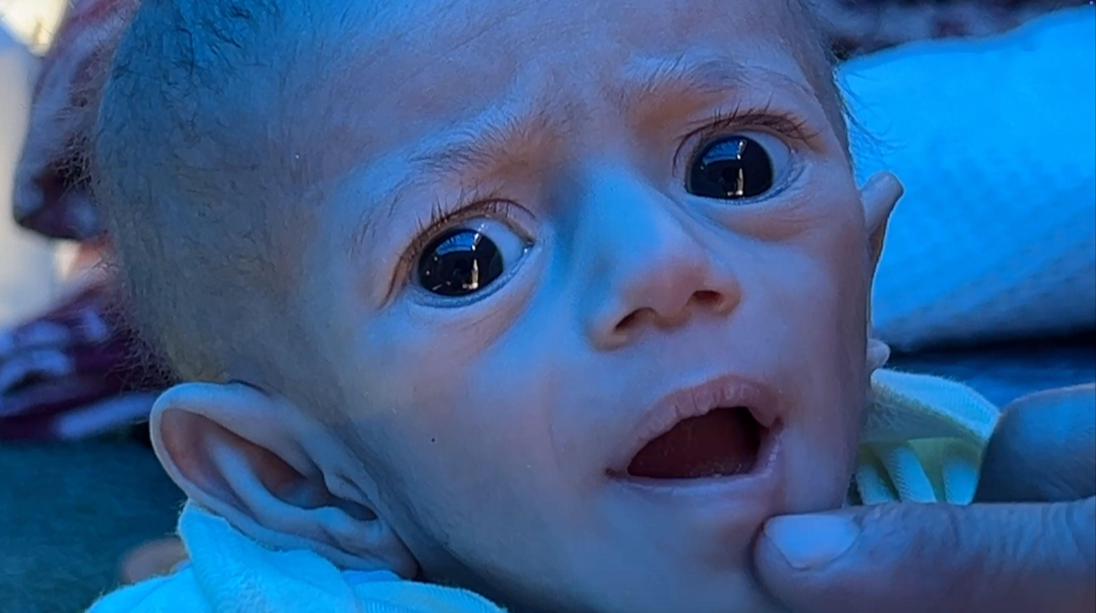 'Situation is dire' - BBC returns to Gaza baby left hungry by Israeli ...