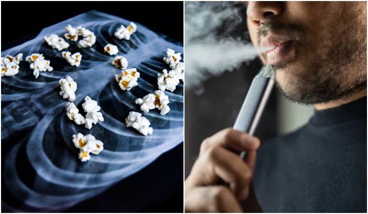 What Is Popcorn Lung And Is It Real?