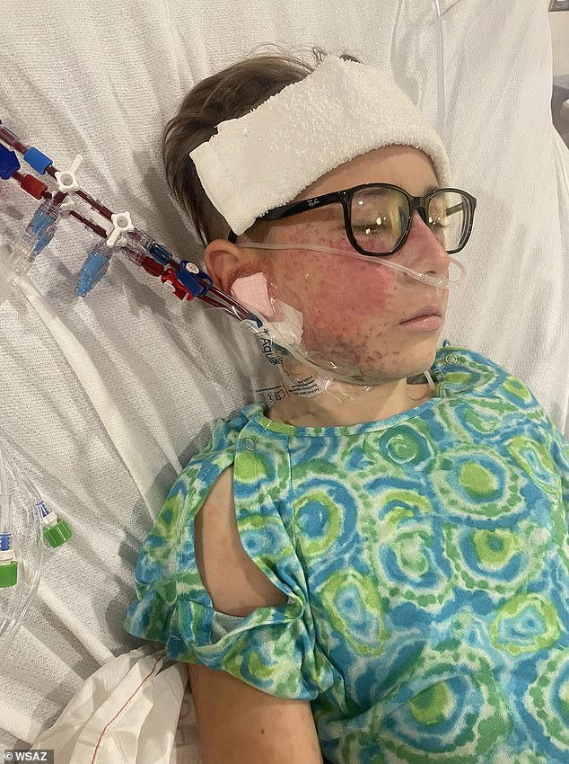 Fears of cover-up as boy, 9, left fighting for life with after eating ...